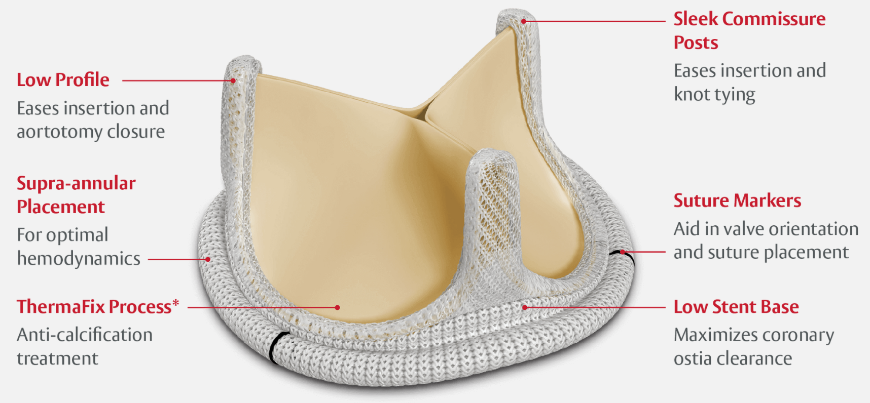 Carpentier Edwards PERIMOUNT Magna Ease Aortic Valve Carpentier Edwards PERIMOUNT Magna Ease Aortic Valve